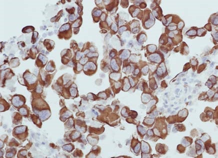 Desmin | Desmin Antibody | IHC | Sakura Finetek USA