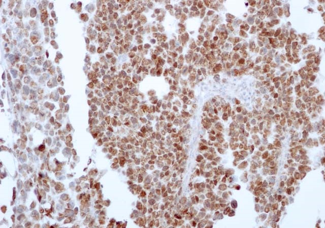 MyoD1 | MyoD1 Antibody | IHC | Sakura Finetek USA
