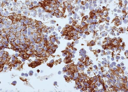 Placental Alkaline Phosphatase | PLAP Antibody | IHC | Sakura Finetek USA